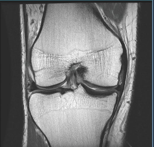 Arthrogram Joint Imaging • Touchstone Medical Imaging