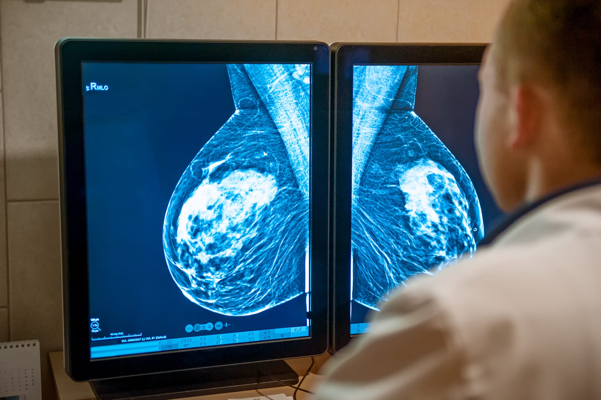 3D Screening Mammography • Touchstone Medical Imaging