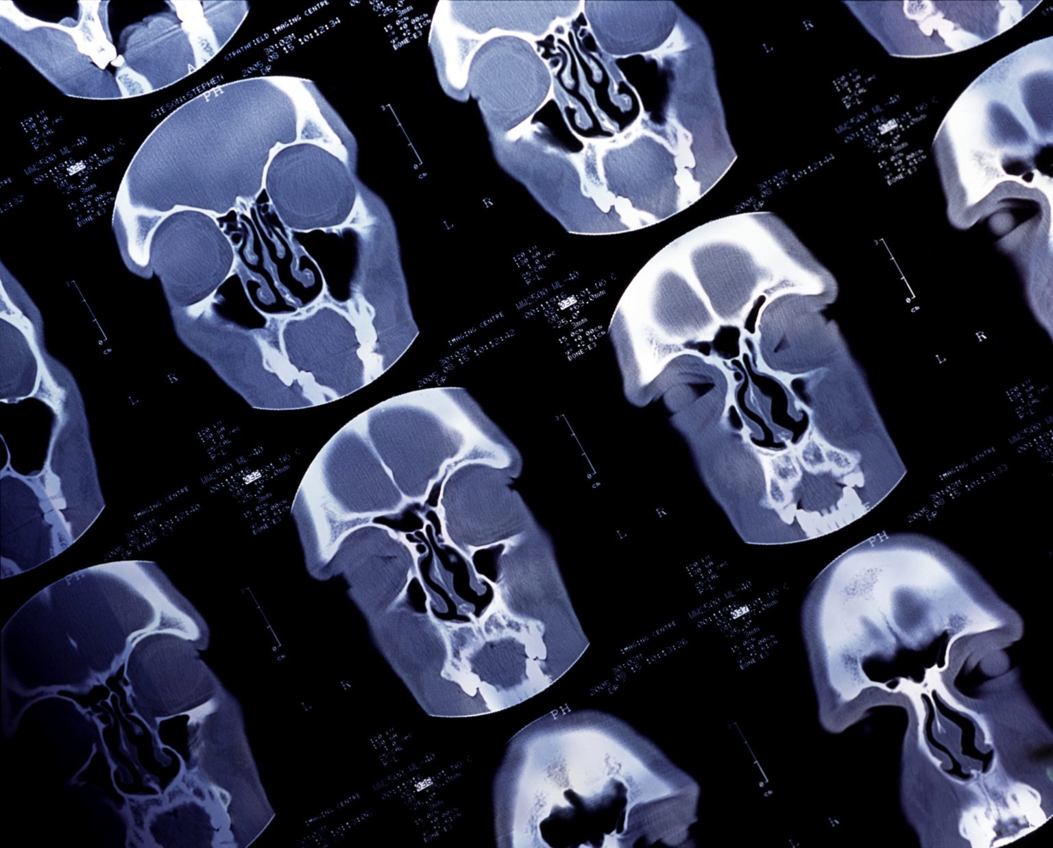 Computed Tomography (CT) • Touchstone Medical Imaging
