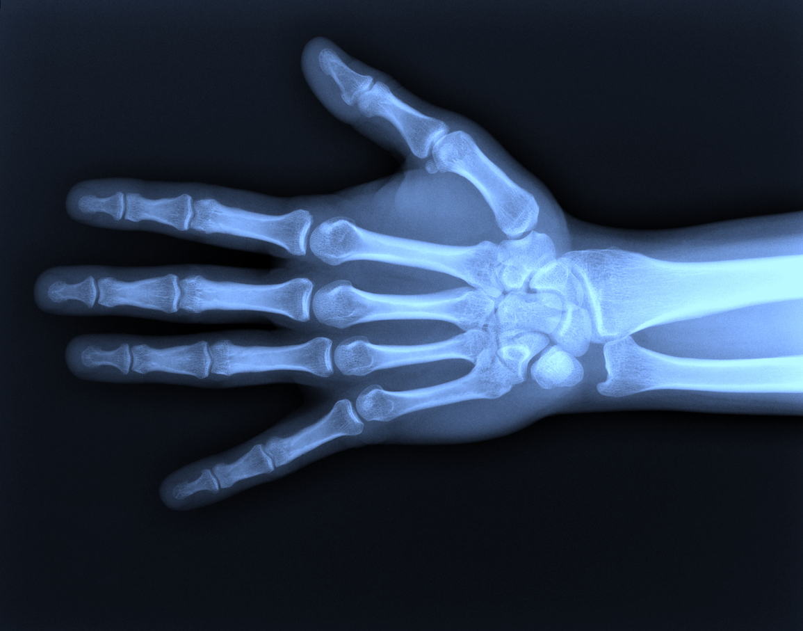Digital X-Ray • Touchstone Medical Imaging